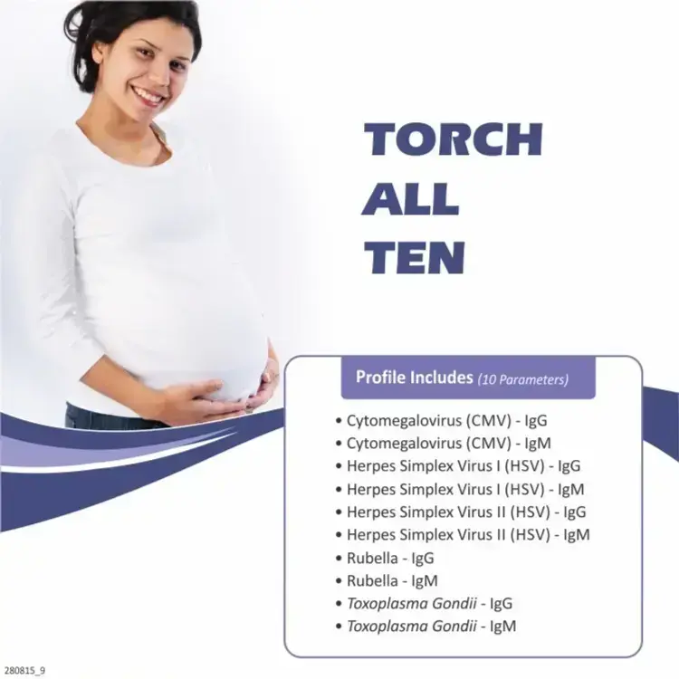 Torch all store